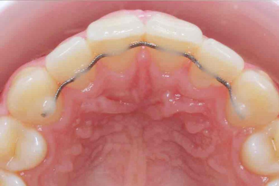 Leistungen - Miriam Mischo – Kieferorthopädin